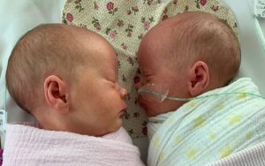 MCMA Twins | Monochorionic Monoamniotic Twin Pregnancy & Birth Story