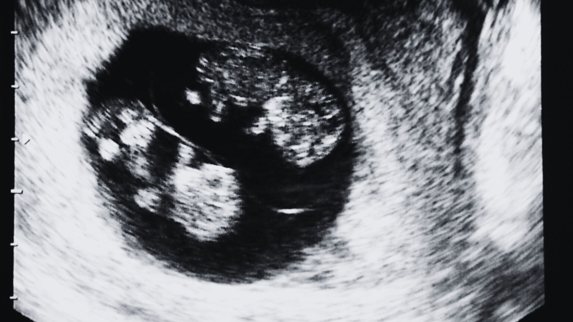 Online Practical Multiple Birth Pregnancy Class | Twinfo