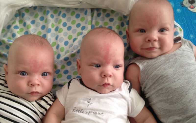 Finding Out We Were Pregnant with Identical Triplets | Twinfo